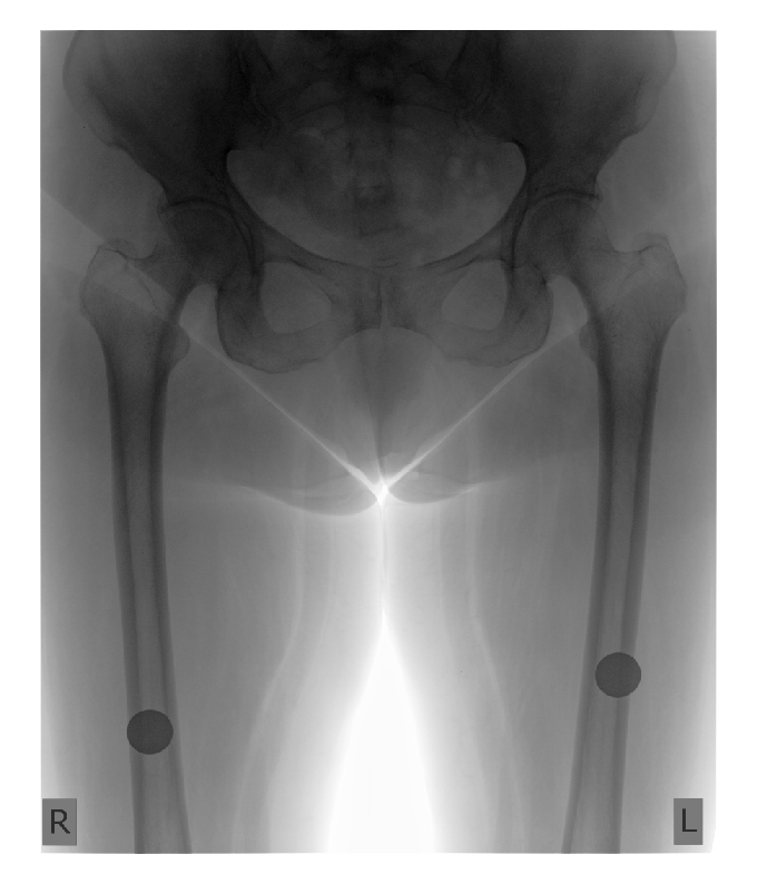 PACS for Radiotherapy - RT Medical Systems