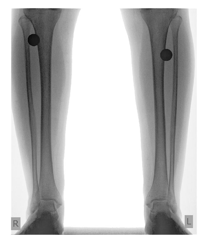 PACS for Radiotherapy - RT Medical Systems