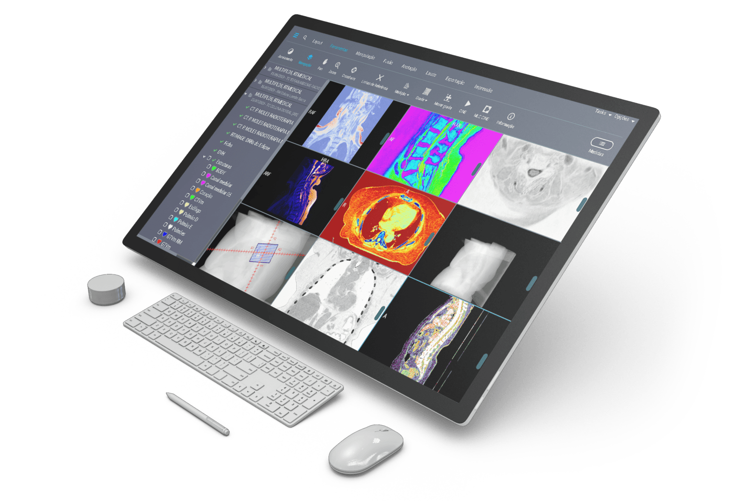 PACS na Saúde: Melhorando o Atendimento ao Paciente por meio da Tecnologia
