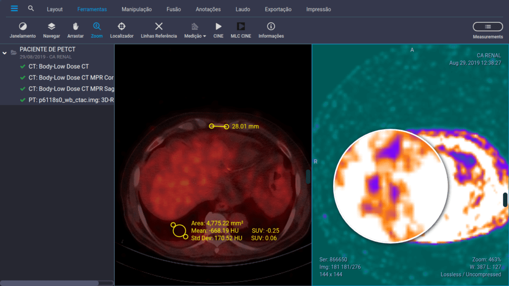 Modalidades de Imagens Médicas no DICOM - RT Medical Systems