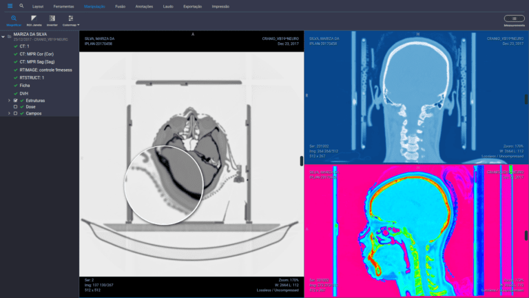 RT Viewer - RT Medical Systems