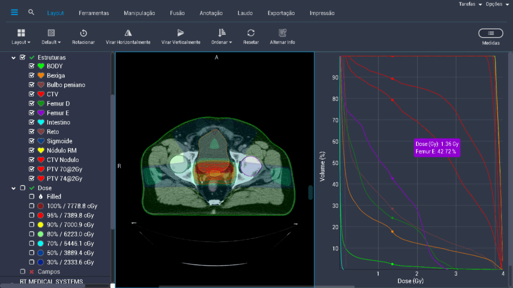 RT Viewer - RT Medical Systems