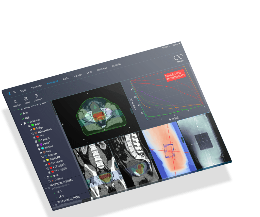 PACS for Radiotherapy - RT Medical Systems