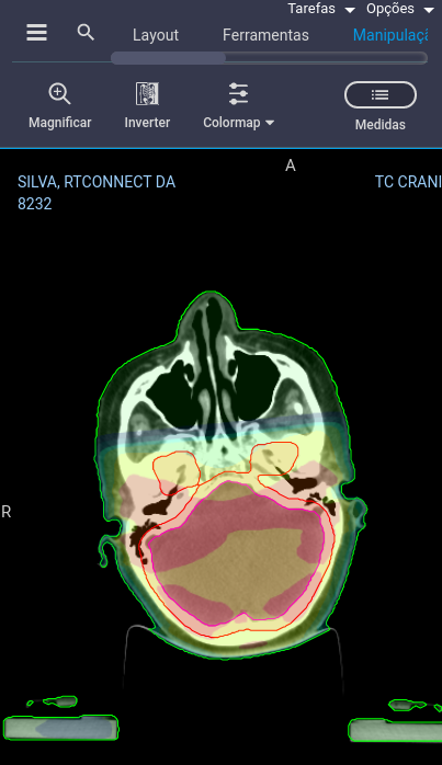 RT Viewer - RT Medical Systems