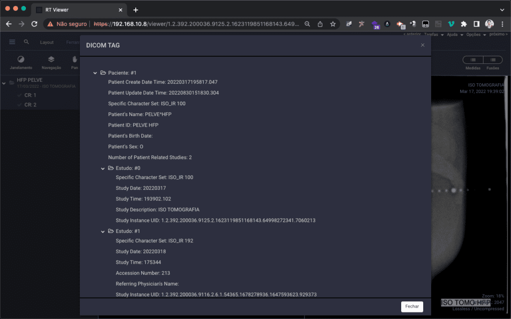 DICOM Tag? - RT Medical Systems