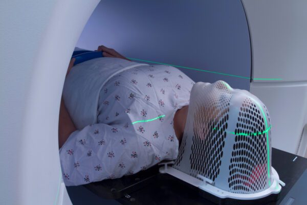 Patient Positioning in Radiotherapy: Ensuring Accuracy and Comfort